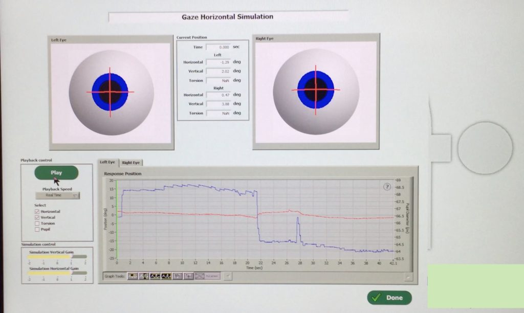 Advanced Eye Tracking in Wildwood and Ocala, FL - Florida Functional ...