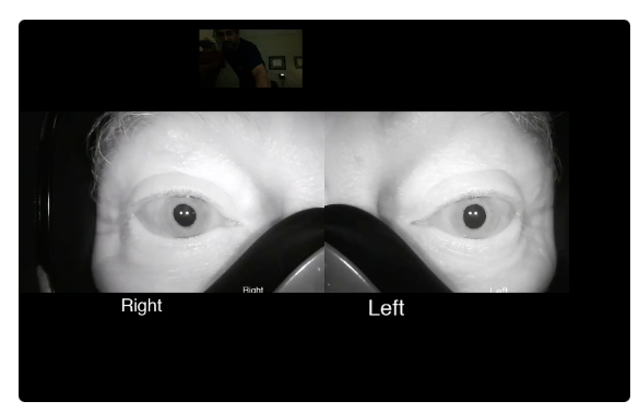 Vertigo Testing & Treatment | Florida Functional Neurology Group